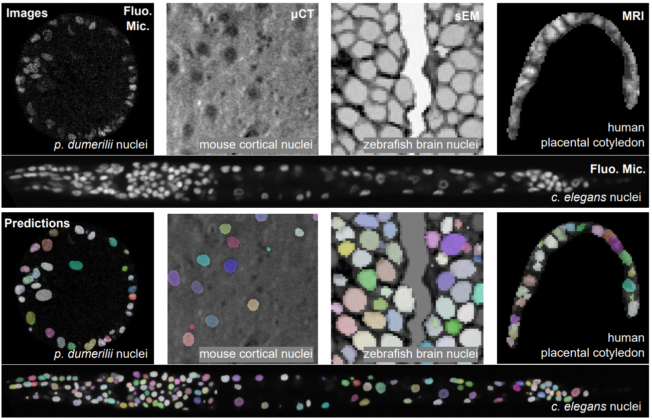Anystar Domain Randomized Universal Star Convex 3d Instance Segmentation Papers With Code 